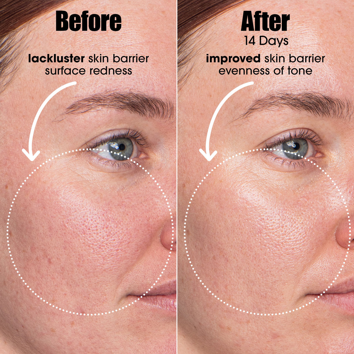 AI Smart Retinoid for Blemish-Prone Skin – Sunday Riley