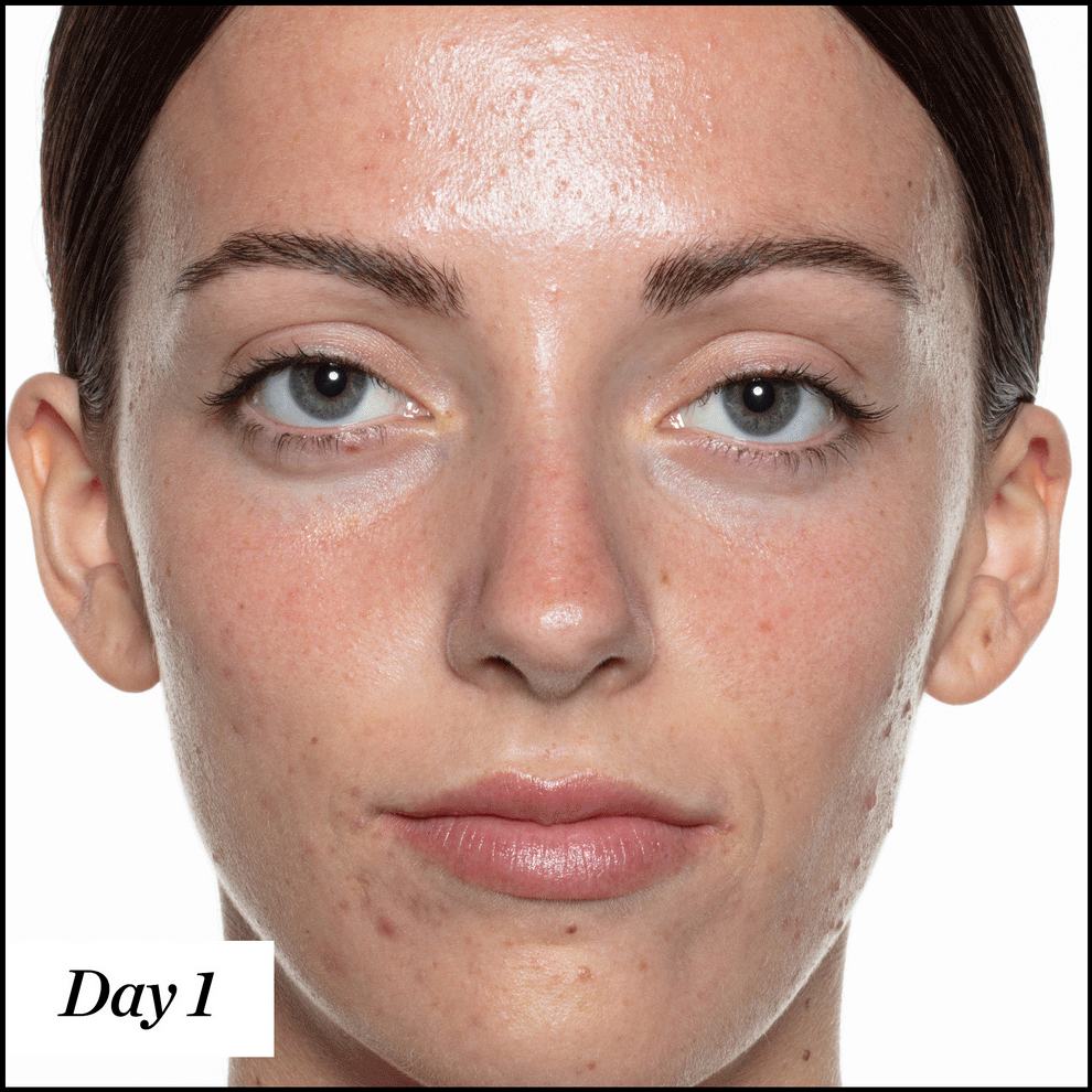 Sunday Riley U.F.O. Acne Treatment Face Oil